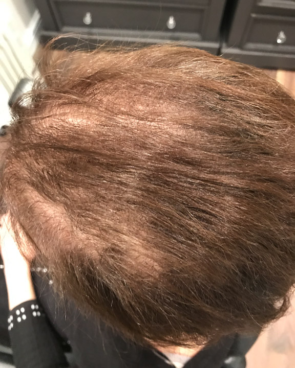 Custom Hair Integration | Secret Hair Extensions