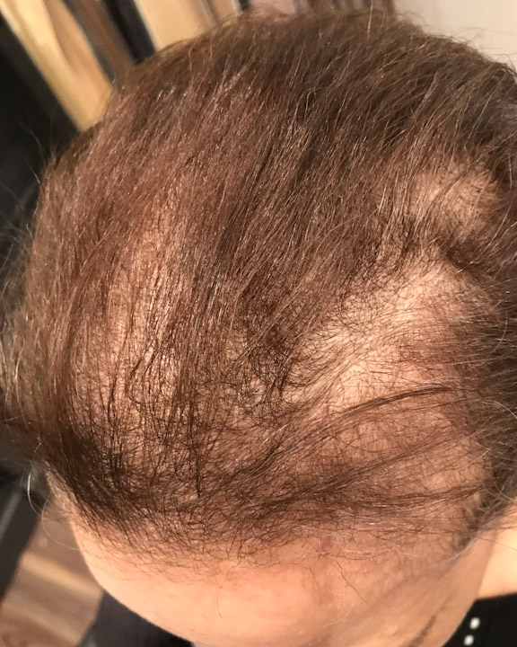 Custom Hair Integration | Secret Hair Extensions